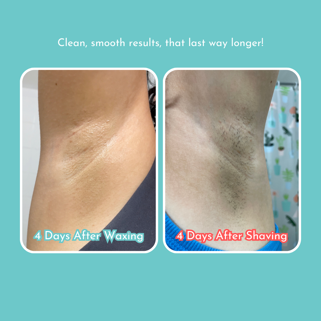 Jelly Wax® All In One Wax Kit